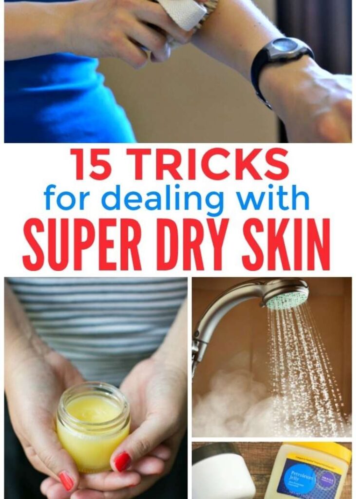 15 Moisturizing Tricks for Super Dry Skin