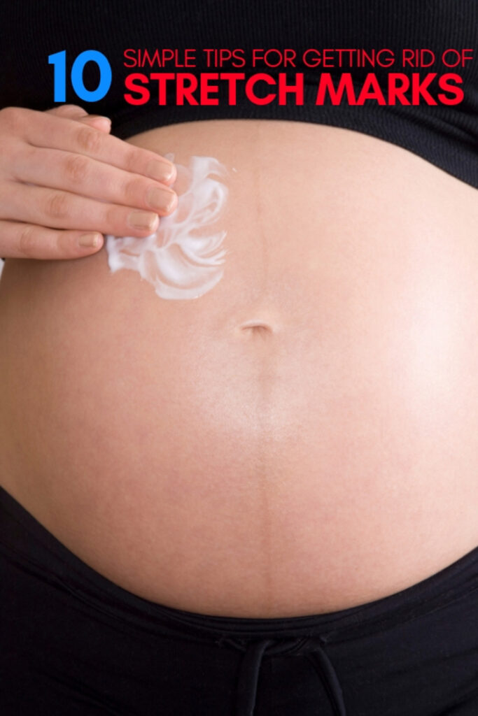 Stretch Marks Removal Tips With Products You Can -Access at Home
